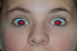 Voici Pourquoi Vous Avez Les Yeux Rouges Sur Les Photos – Recettes ...